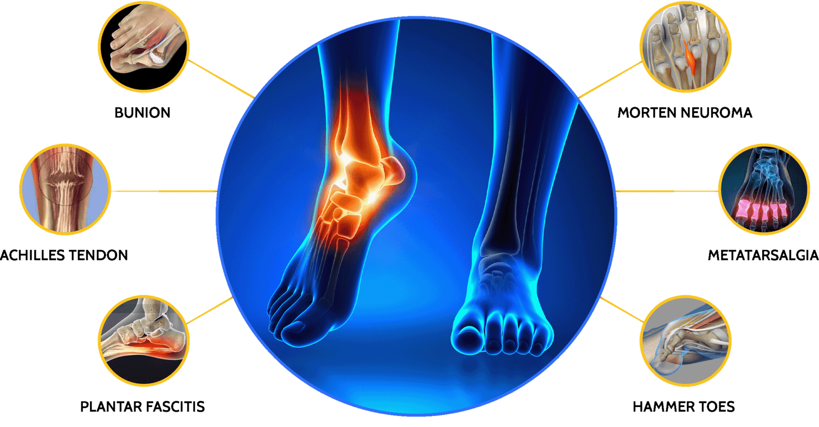 Fixifoot Product Review - Fixilab
